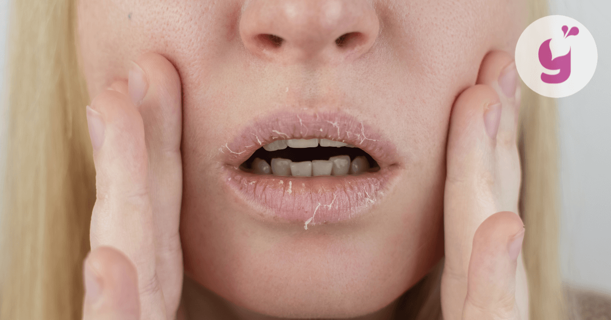 Čo na suché a popraskané pery? Príčiny a 7 účinných tipov